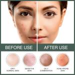 Buy She Essentials 2% Salicylic Face 30ml Serum For Acne, Blackheads ...