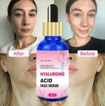 Buy AMR Beauty | Hyaluronic Face Serum | 30ml_02 Online at Best Prices ...