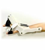 Buy IGR Metal Beige Dynamic Radial Palsy Splint - 90 Kg Online at Best ...