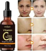 Buy Vedant Oil Free Face Serum For All Skin Type - 30 ml Online at Best Prices in India - JioMart.