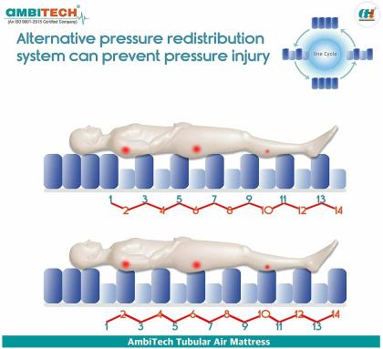 AmbiTech Anti-Decubitus Anti-Bedsore Tubular Air Mattress - JioMart
