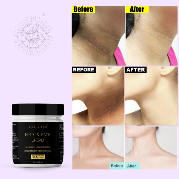 NECK BACK CREAM - JioMart