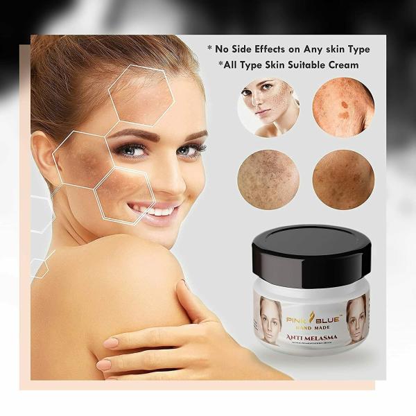 Pink Blue Handmade Anti-melasma cream to reduces Dark & Brown Spots ...
