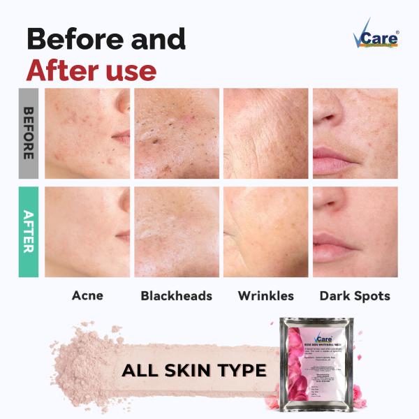 VCare Rose Skin Whitening Mask -50GM - JioMart