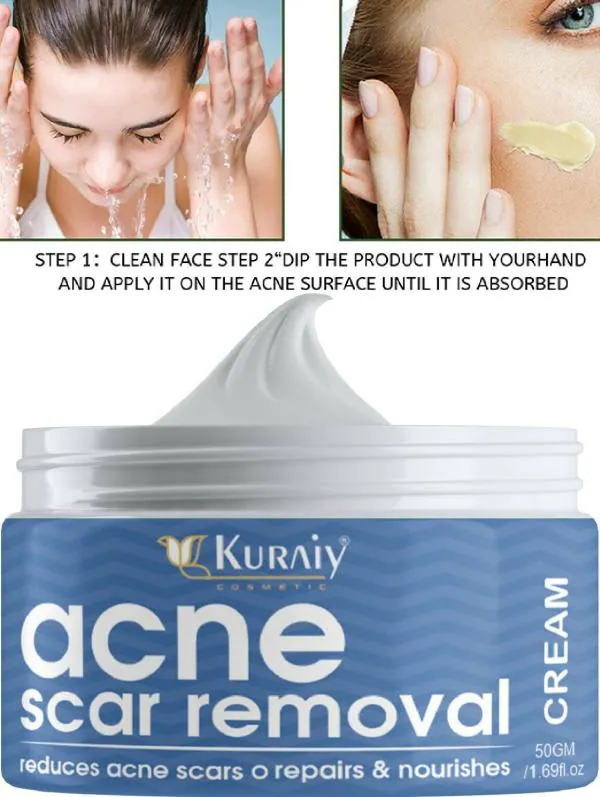KURAIY New Acne Scar Removal Cream Pimples Stretch Marks Surgical ...