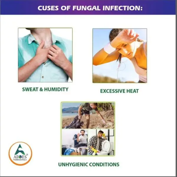 Alloes Alodust Anti Fungal Powder For itching,Prickly Heat on Back,neck ...