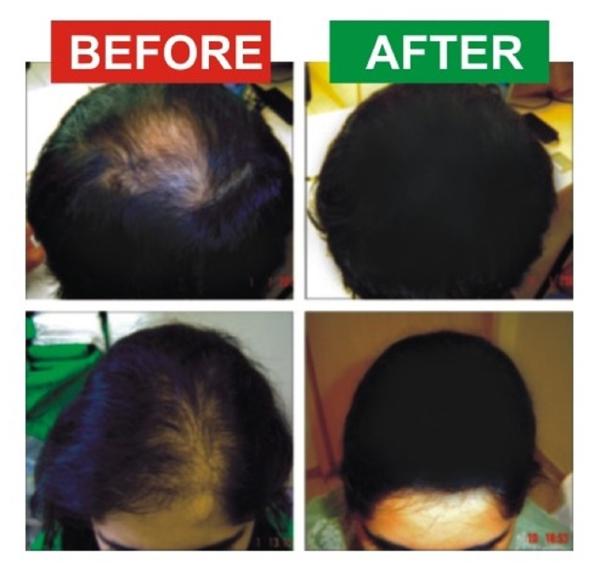 Hairouse Natural Hair Building Microfibers (Medium Brown) 6 Gms - JioMart