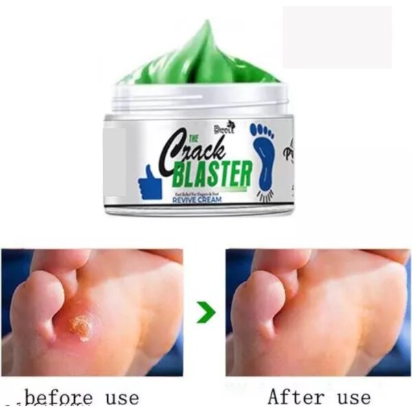 Crack Blaster cream Smooth Foot Crack Cracked Heel Repair Foot Cream ...