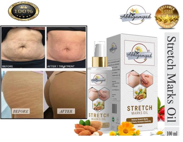 Abhigamyah Stretch Mark oil, stretch marks remover for Stomach, thighs & all body parts - JioMart