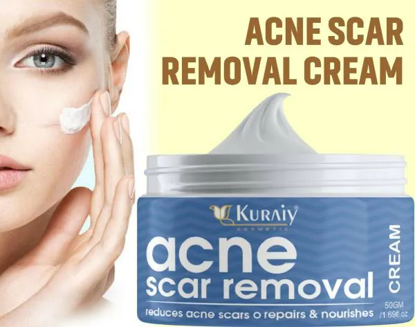 KURAIY ACNE SCAR CREAM 50GM - JioMart