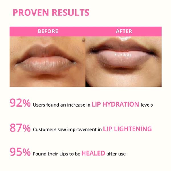 ALANNA Lemon Lip Balm - JioMart