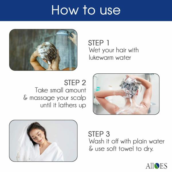 Alloes Anti-Dandruff Ketoclean Shampoo for Relief of Itching and ...