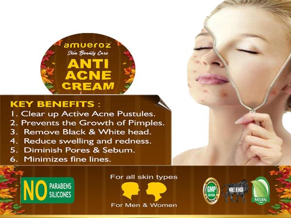 Amueroz Anti Acne Cream, Reduce Pigmentation, Blemish, Pimples, Dark ...