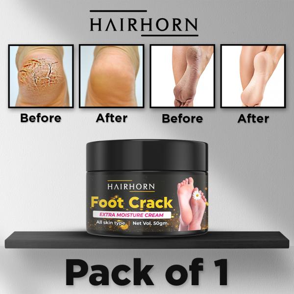 HairHorn feet crack heel repair cream Smooth Foot Crack Cracked Heel ...