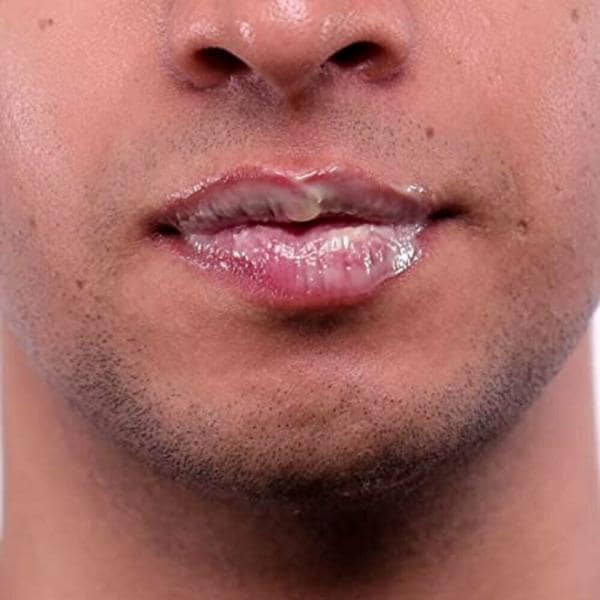 Skinncells Deep Veil - Instant 7-min Lip Mask for Men| Best for Dry ...