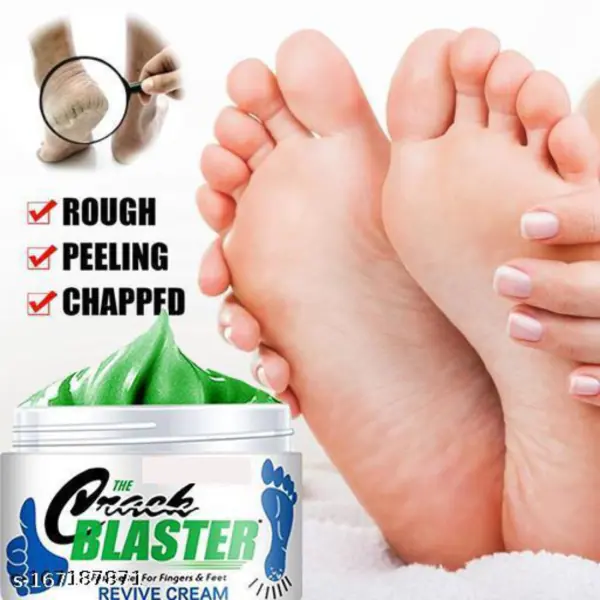 Extraposh Crack Heel Repair Cream. Crack Blaster Repair Cream (100 g ...