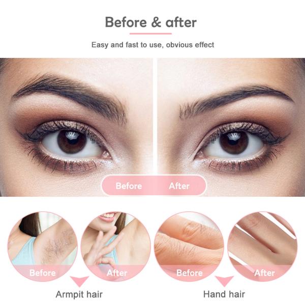 Virth Hair Remover Machine For Women-Upper Lip, Eyebrow, Face, Lips ...