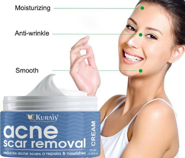 KURAIY Natural Herbal Acne Treatment Cream Pimples Scar Removal Facial Cream Oil Control Shrink ...