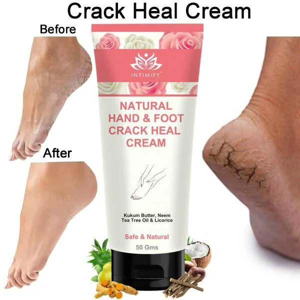 Intimify Hand & Foot Crack Heal Cream for Crack of Foot, Heals, Hands ...