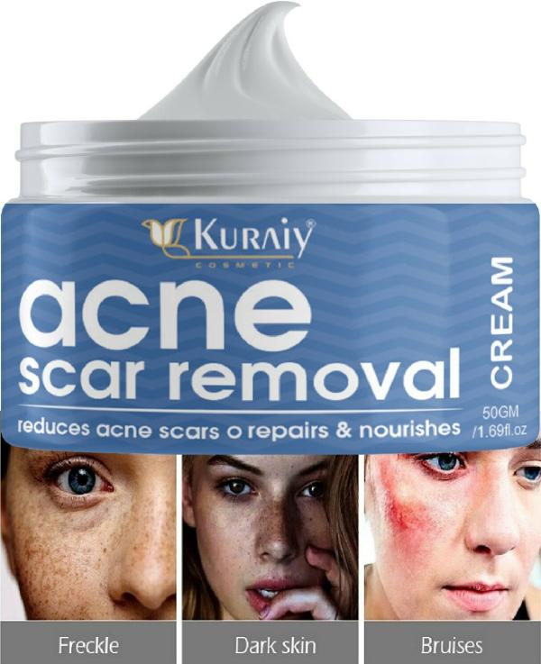 KURAIY ACNE SCAR CREAM 50GM - JioMart