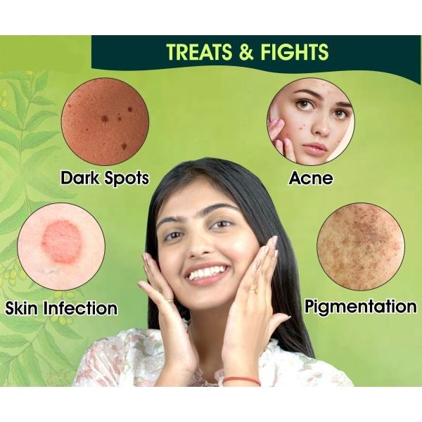 NESTREEZ AVIRA Neem Oil for Hair, Skin, Nails, Acne, Removes Pimples, and Cure Any Fungal ...